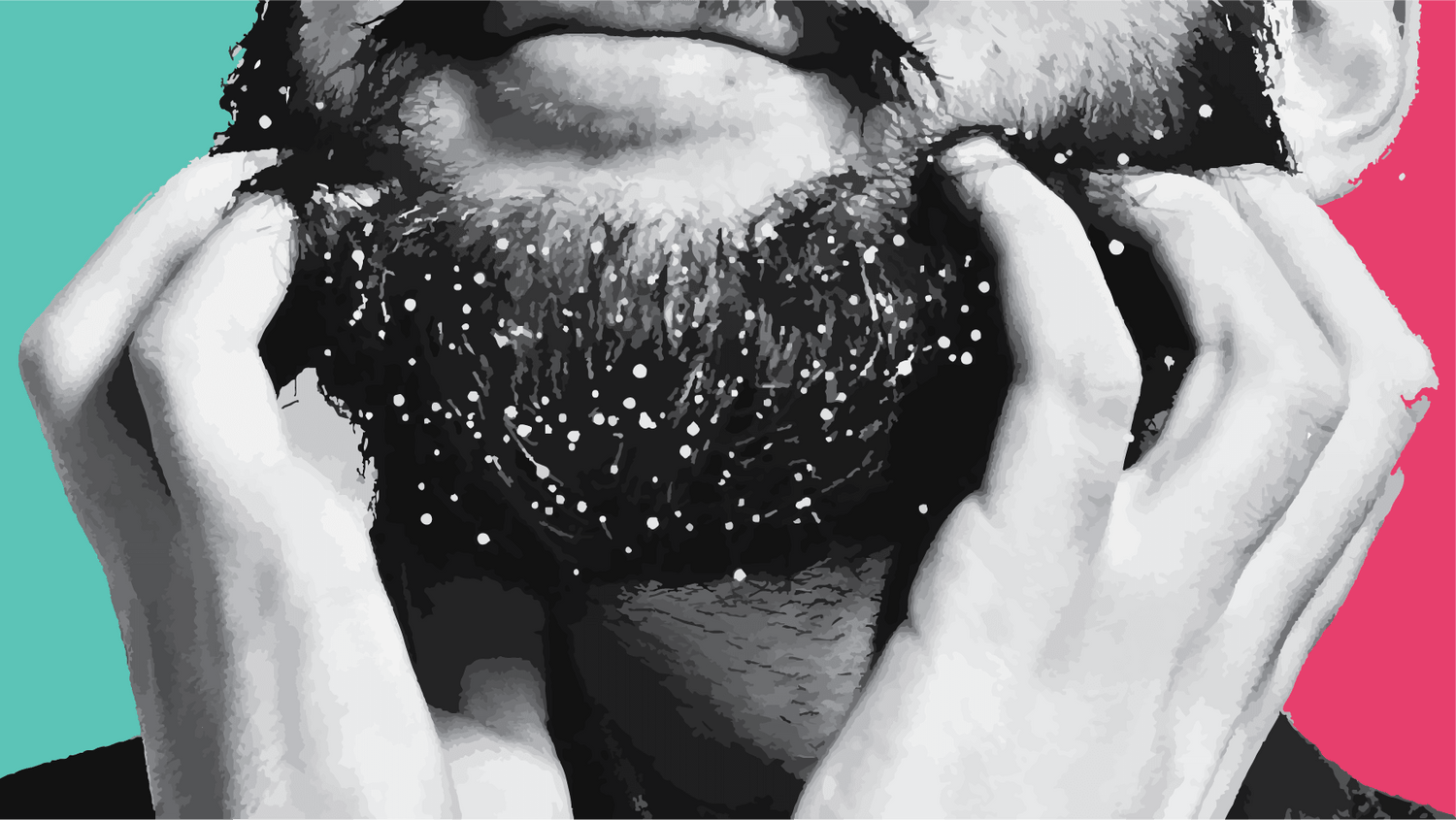 Beard Dandruff 101: What Causes It and How Can You Treat It?
